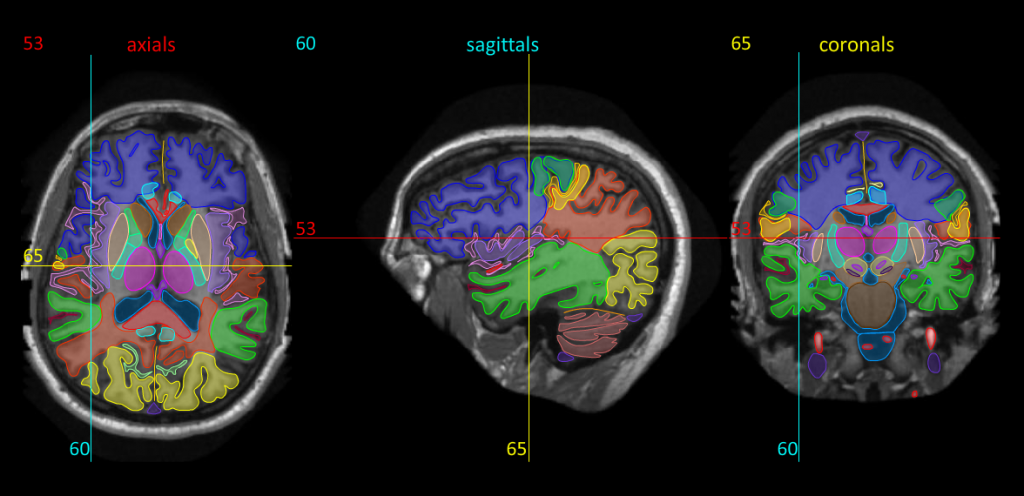 Irvine Brain Bee Study Materials - Center for the Neurobiology of ...